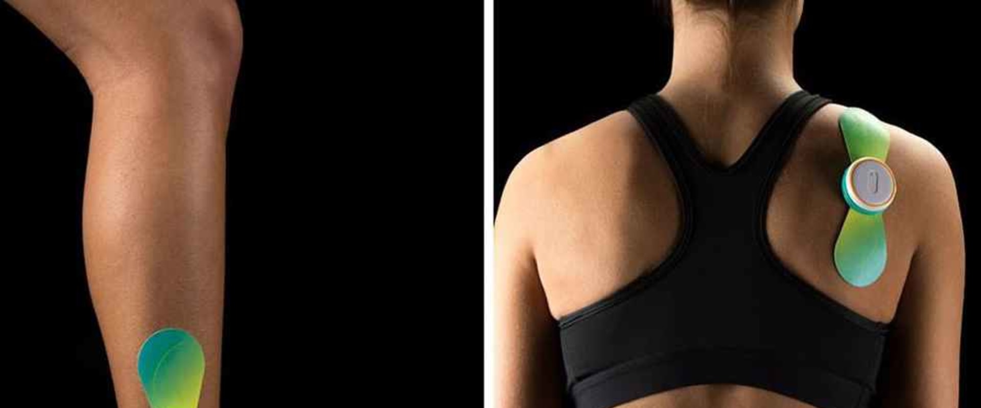 TENS Therapy: A Comprehensive Guide to Treating Dental Pain